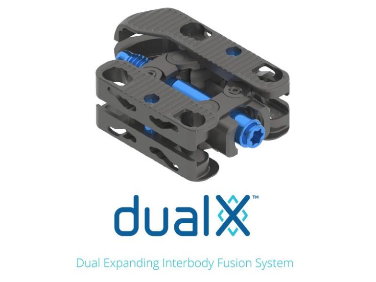 Salari Implants Hyperlordotic dualX Interbody Cage | DISC