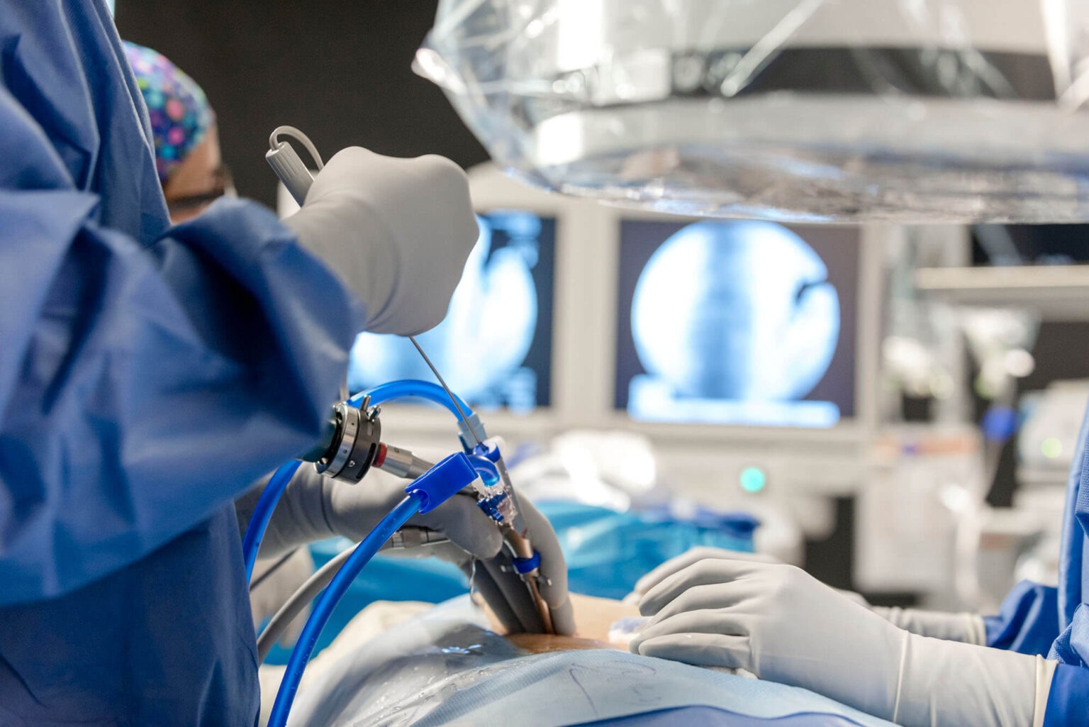 Endoscopic Spine Surgery: Procedure and Benefits | DISC