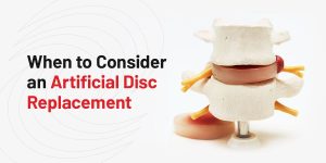 When To Consider An Artificial Disc Replacement | DISC