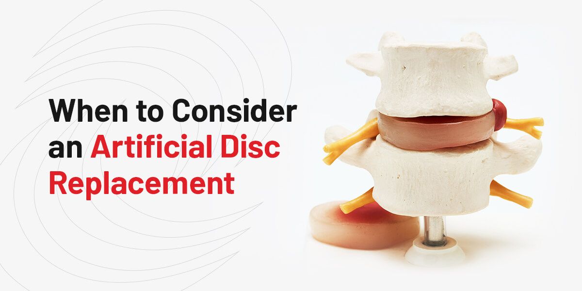 When To Consider An Artificial Disc Replacement | DISC