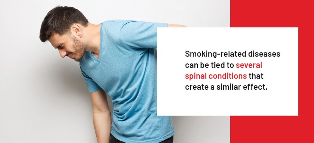Smoking & Back Pain | Desert Institute for Spine Care