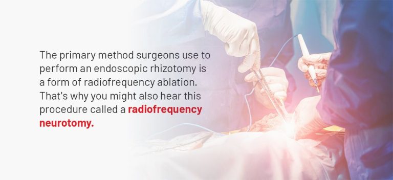 How an Endoscopic Rhizotomy can Help Your Lower Back Pain