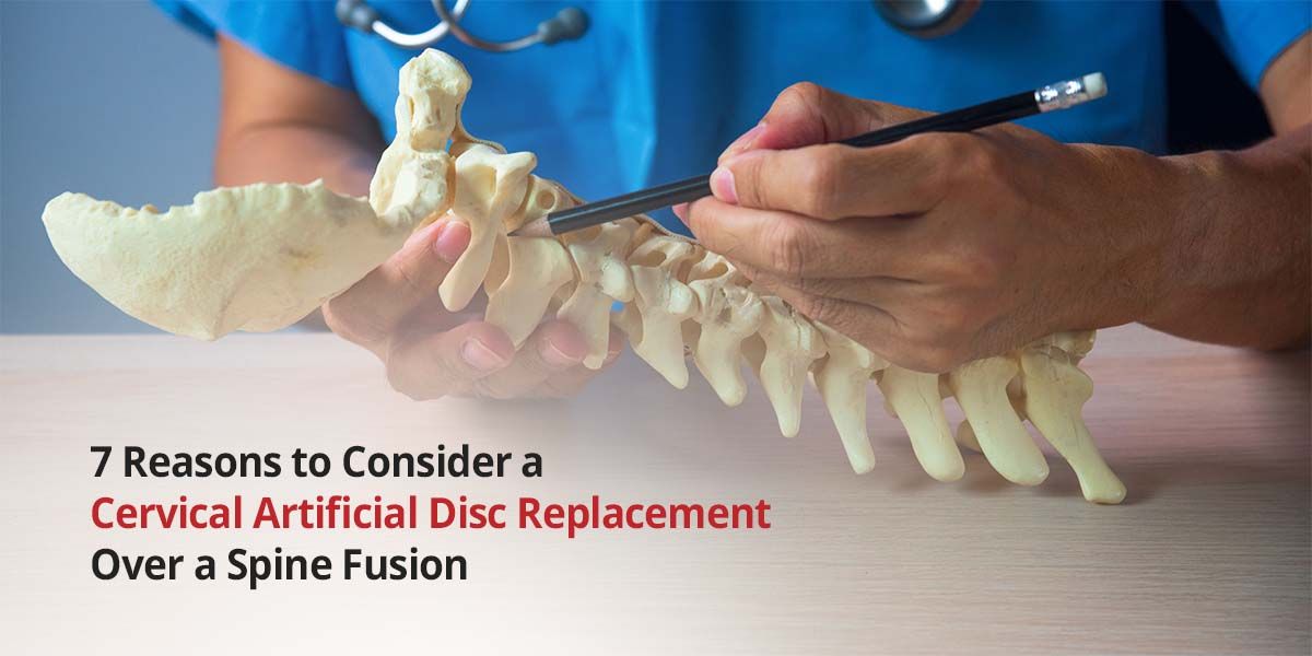 Choose a Cervical Artificial Disk Replacement over a Spine Fusion