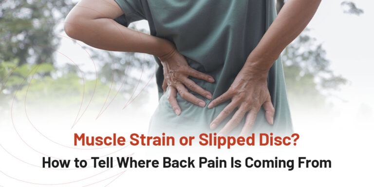 Muscle Strain or Slipped Disc? How to Tell Where Back Pain Is Coming ...