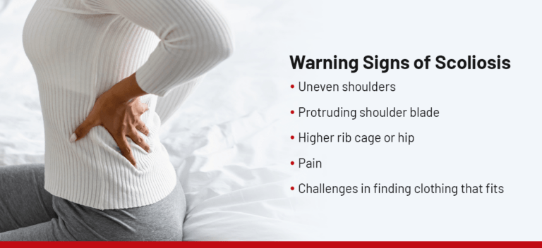 How to Tell if You Have Scoliosis | DISC