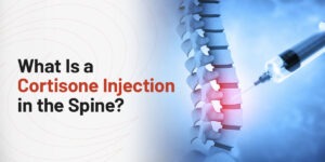 What Is a Cortisone Injection in the Spine? - Desert Institute for ...