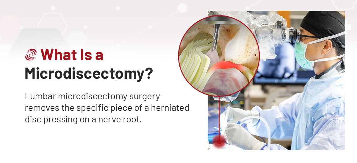 Differences Between Laminectomy, Microdiscectomy and Laminotomy ...